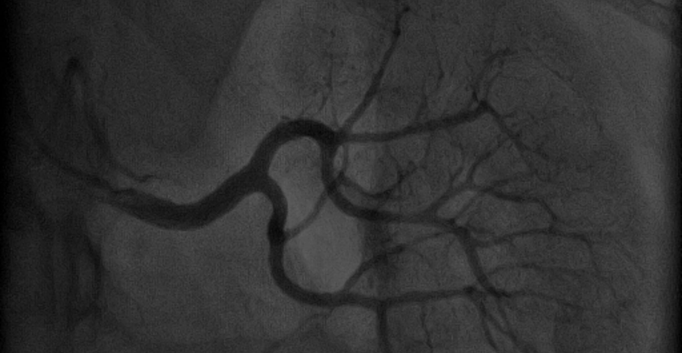 Gefäßkrankheiten - Angiologie - Internistenzentrum (MVZ Gauting-Starnberg)